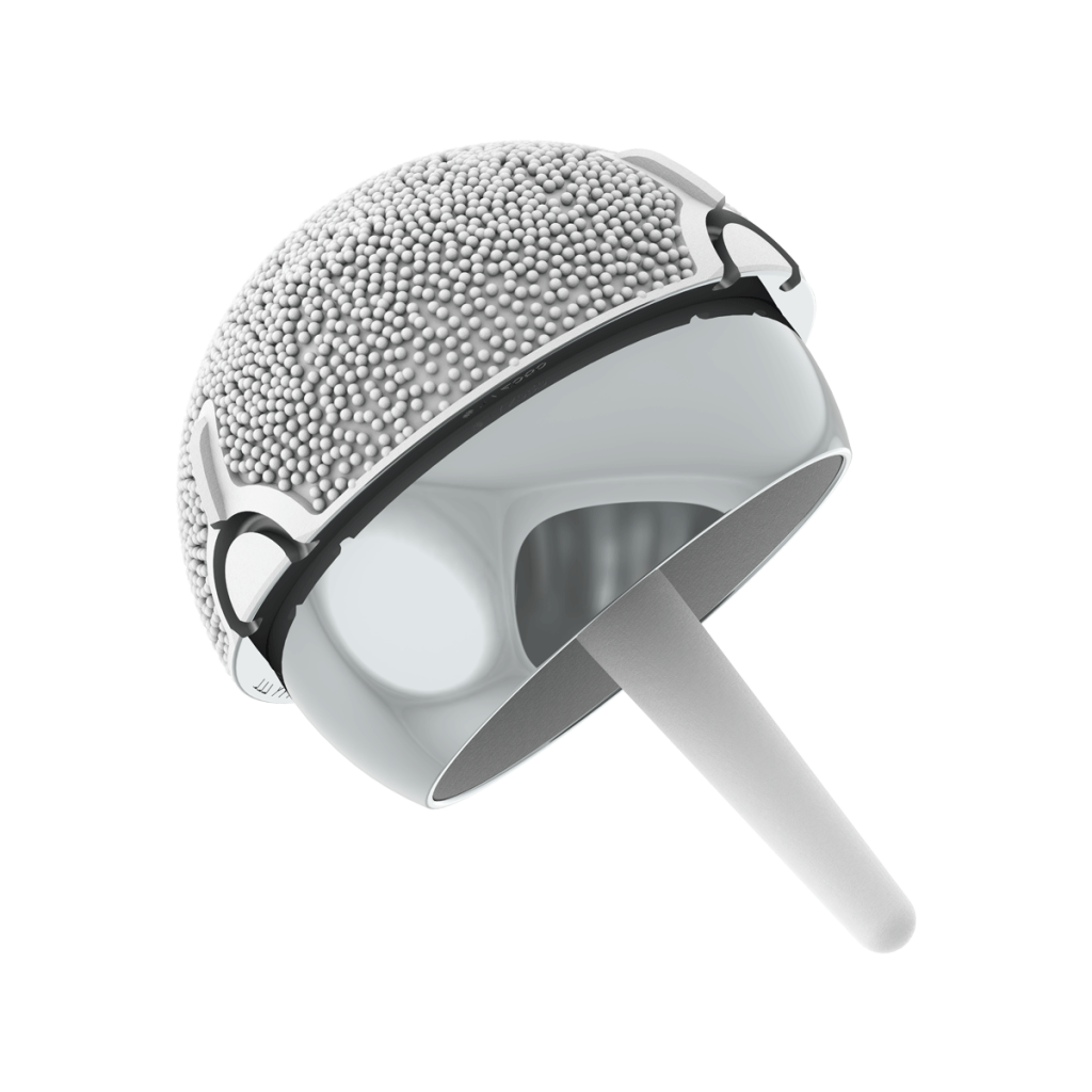 Hip Resurfacing: A Game-Changer for Athletes with Arthritic Hips ...